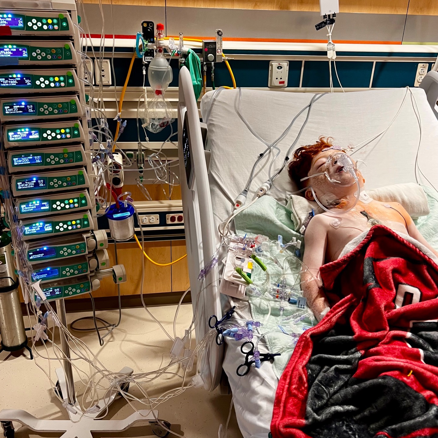 Support for Dalton’s Emergency Heart Surgery and Recovery - Give InKind
