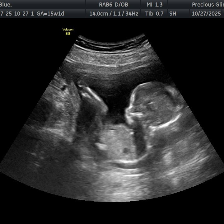 Welcoming Baby Girl Blue (Arriving in April) - Give InKind